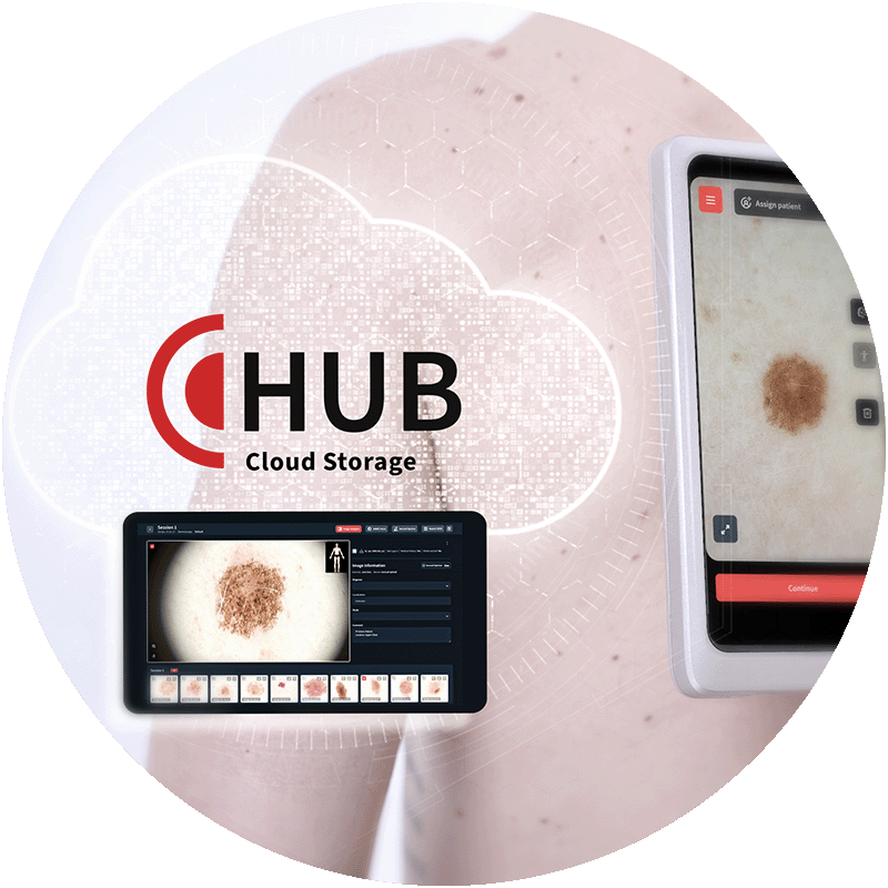 skeen | mobiles digitales Dermatoskop – FotoFinder Systems