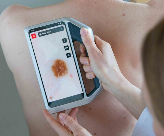 skeen | mobiles digitales Dermatoskop – FotoFinder Systems