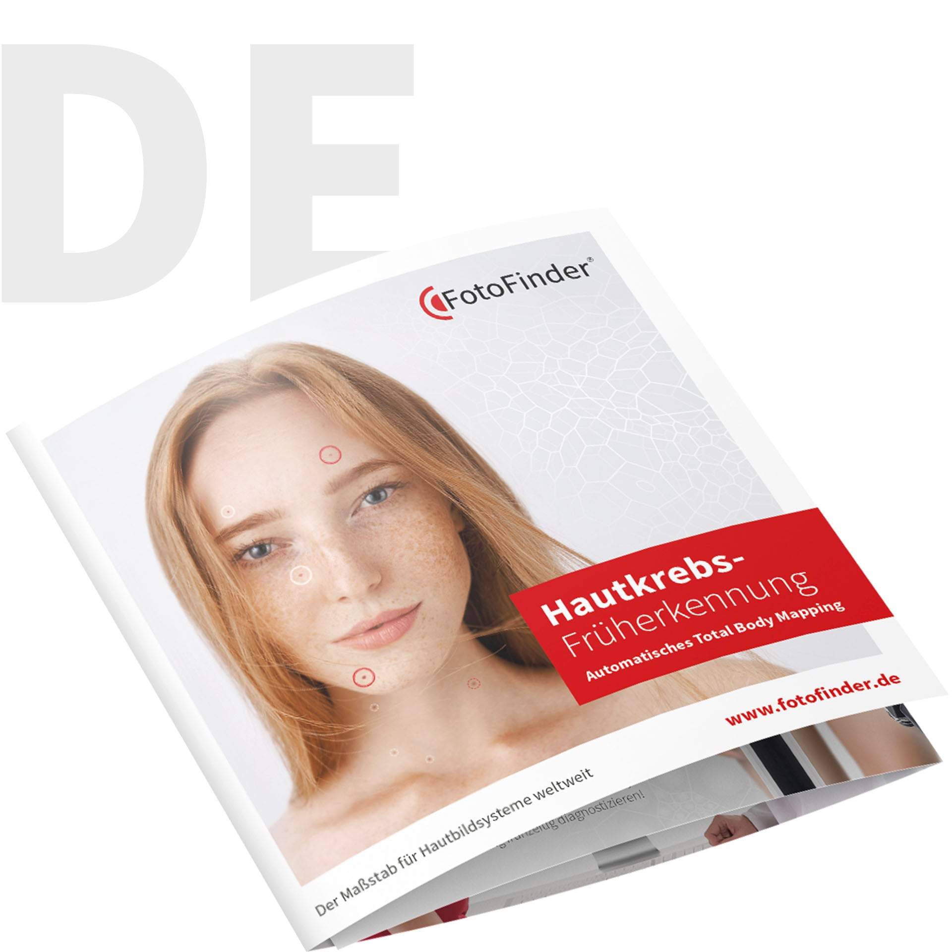 Patient Brochure Total Body Mapping – FotoFinder Systems