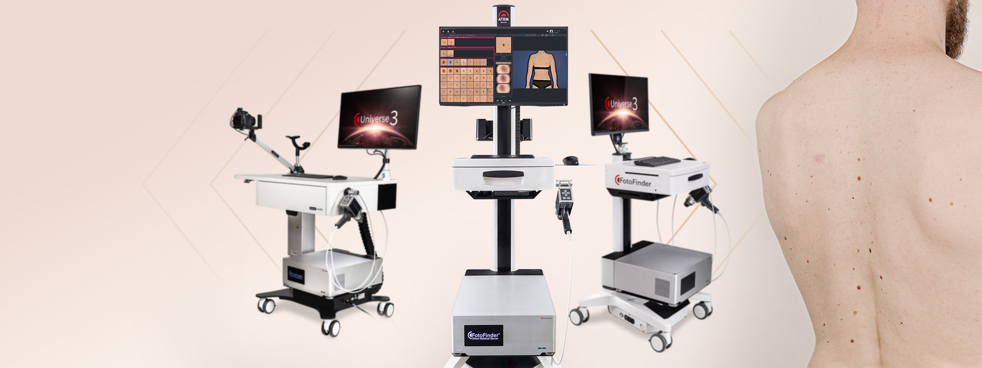 Systems | FotoFinder Systems Shop